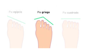 Tipos de pies. ¿Sabes cuál es el tuyo y qué dice sobre ti?
