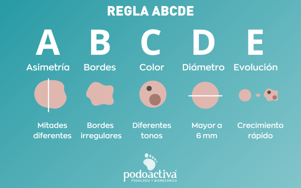 Lunares en los pies: Por qué salen y qué significan