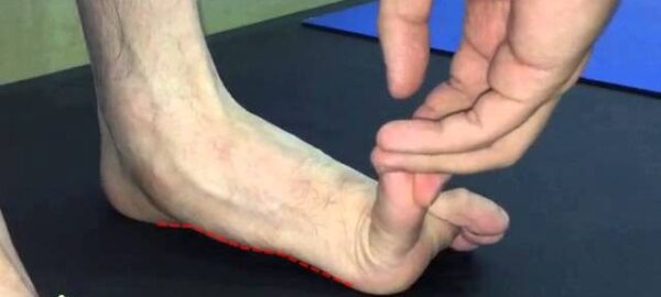 Test de Jack: En qué consiste y para qué sirve - Podoactiva. Podología ...