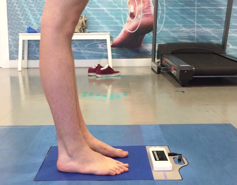 Caso clínico: Hiperlaxitud ligamentosa - Podoactiva. Líderes en Podología